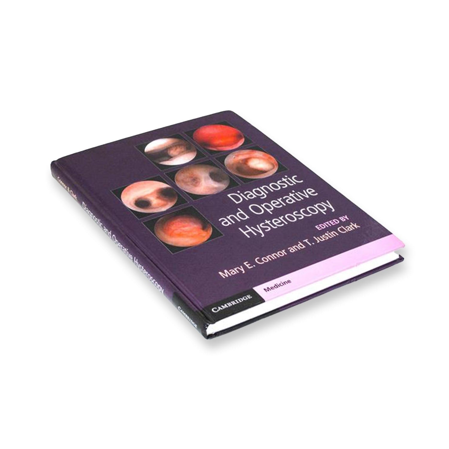 Diagnostic And Operative Hysteroscopy - Hardcover | 9781107111608 ...
