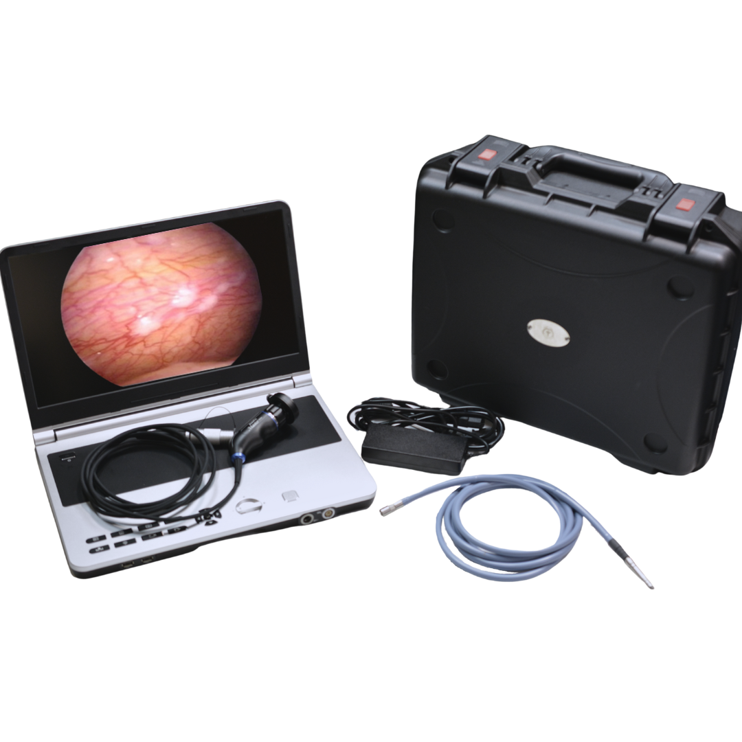 Wolf Light Post Adapter for Storz Scopes | 495W-S – Endoscopy Superstore