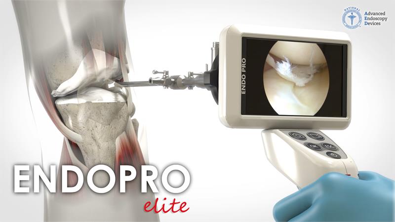 AED ENDOPRO-CAM® ELITE Portable HD Endoscopic Video System | EP2000 ...