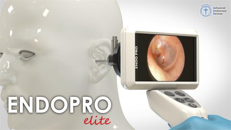 AED ENDOPRO-CAM® ELITE Portable HD Endoscopic Video System | EP2000 ...