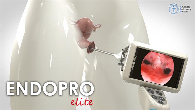AED ENDOPRO-CAM® ELITE Portable HD Endoscopic Video System | EP2000 ...